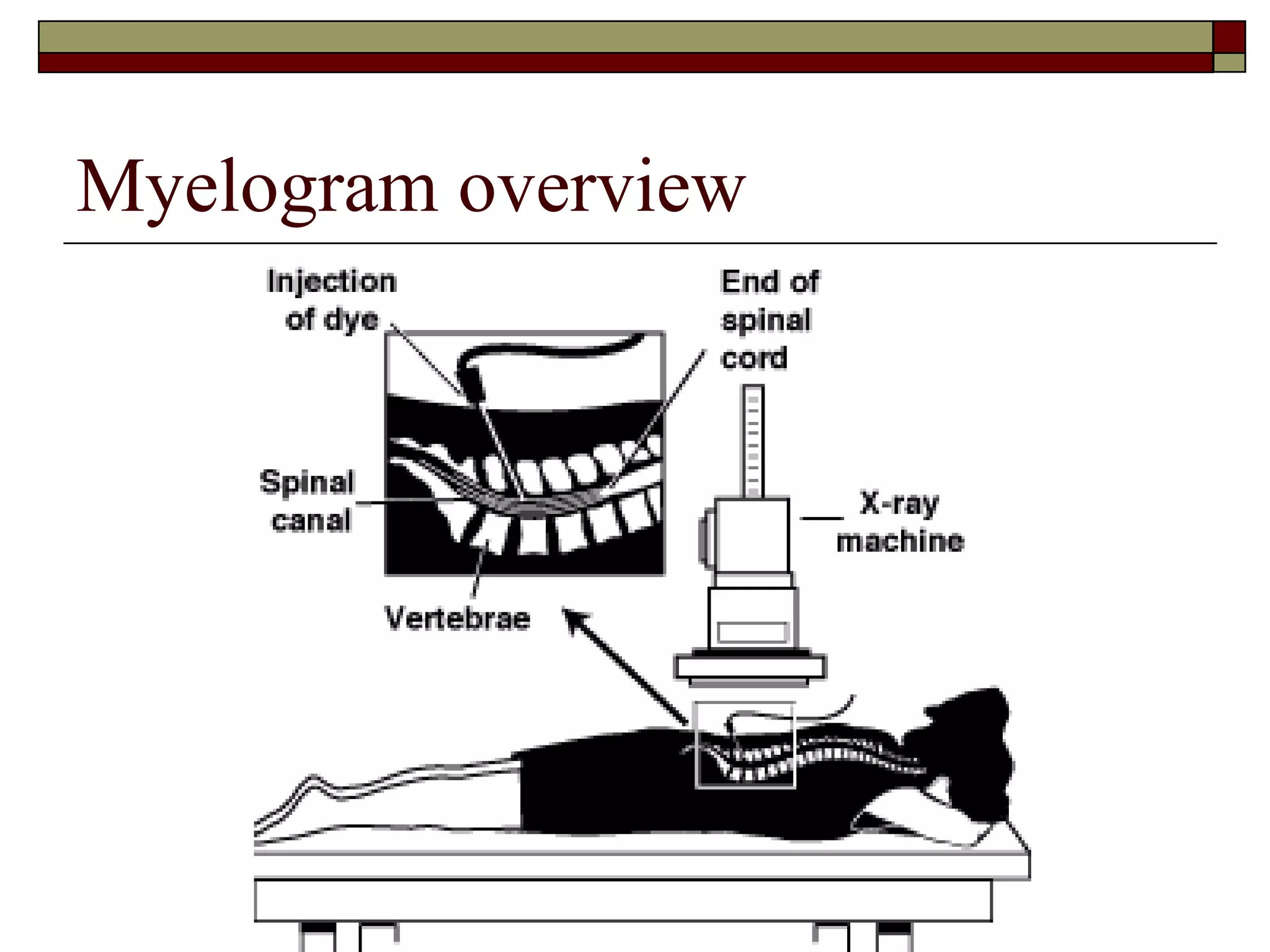 Myelography | PPT