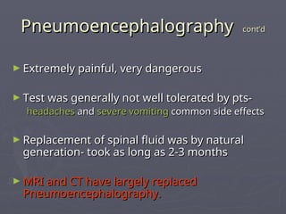 myelography.pptndnsmsmkslskdmdmmnnsnksmsm | PPT