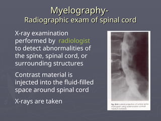 myelography.pptndnsmsmkslskdmdmmnnsnksmsm | PPT