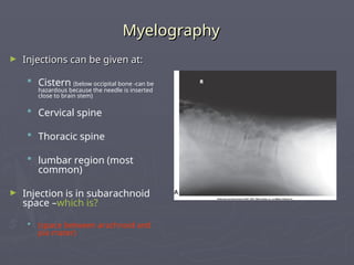 myelography.pptndnsmsmkslskdmdmmnnsnksmsm | PPT