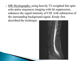 Myelography PPT bmit 4th Semester .pptx
