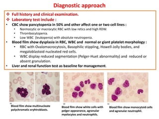 Myeloid disorders | PPTX