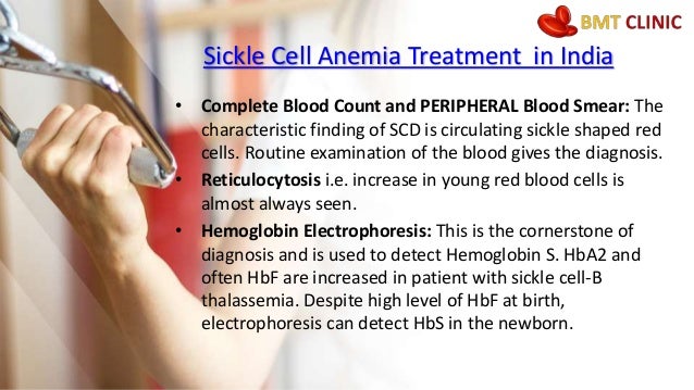 Sickle Cell Anemia Treatment in India