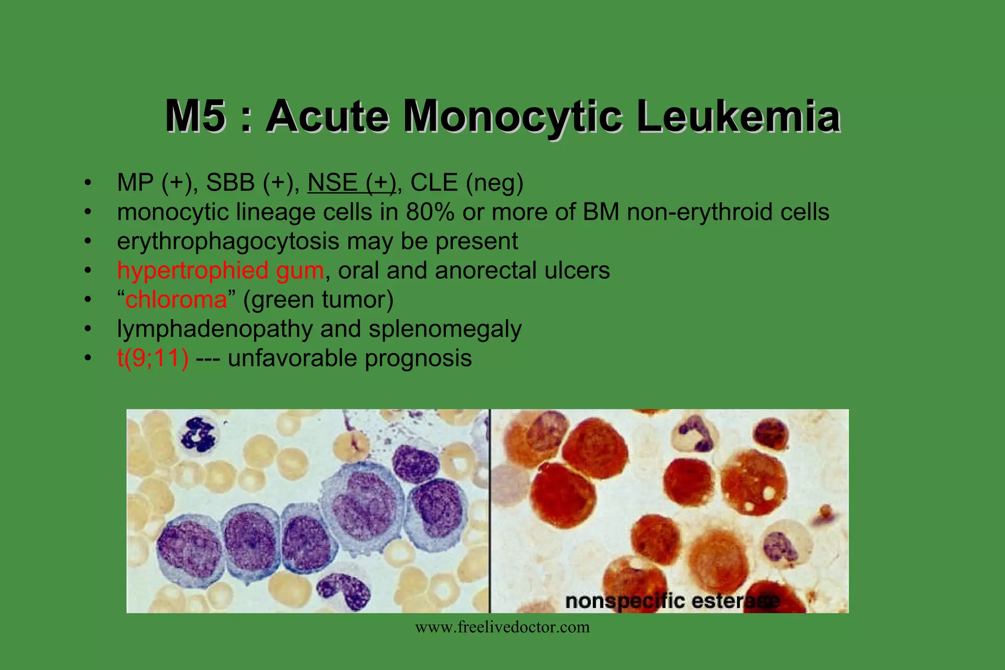 Myeloproliferative | PPT