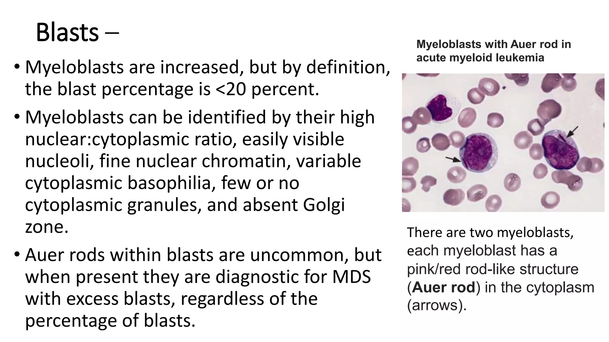 Myeloproliferative disorders | PPTX