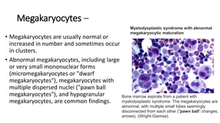 Myeloproliferative disorders | PPTX