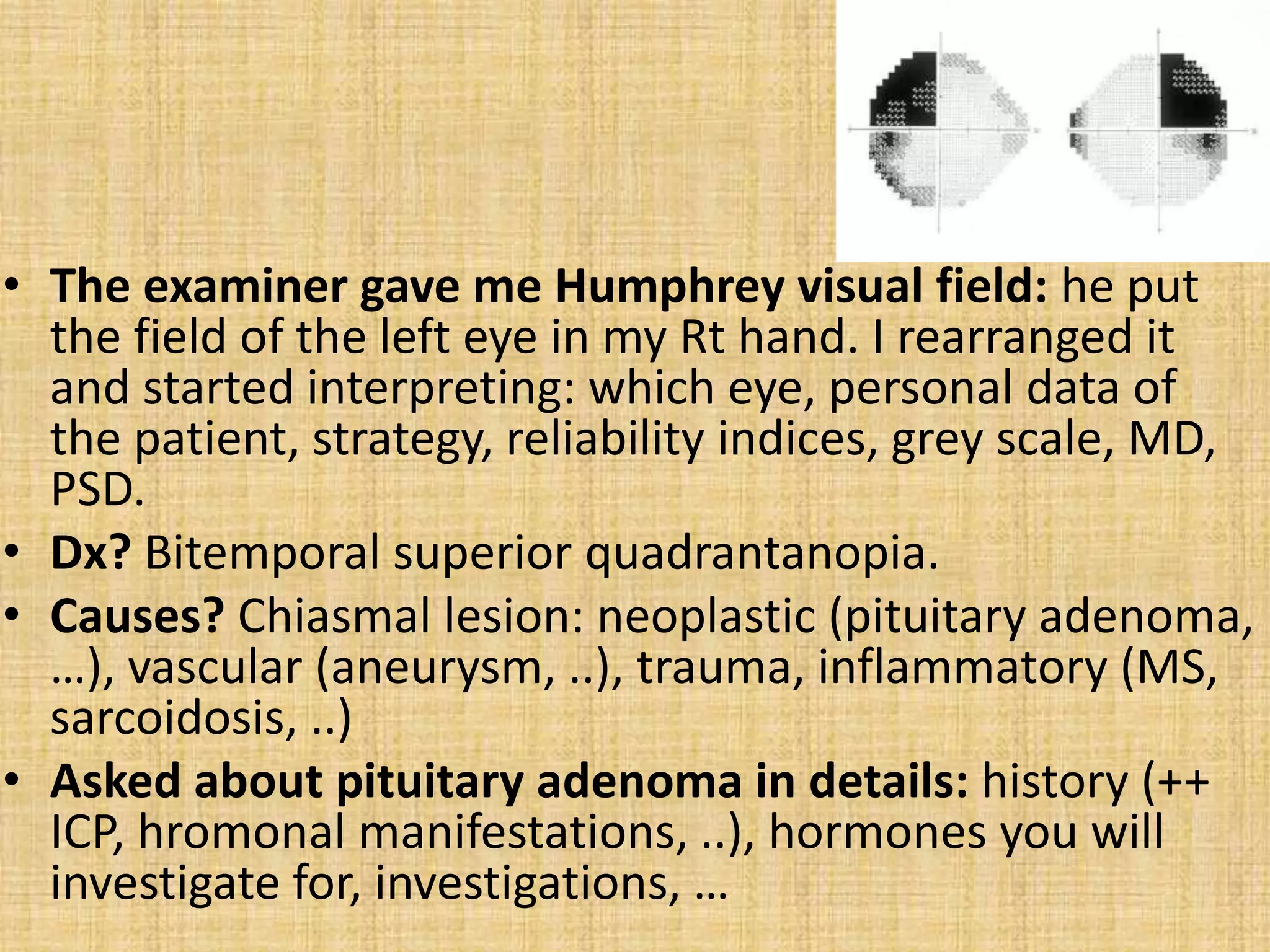 My experience in FRCS Glasgow ophthalmology | PPTX | Eye and Vision ...