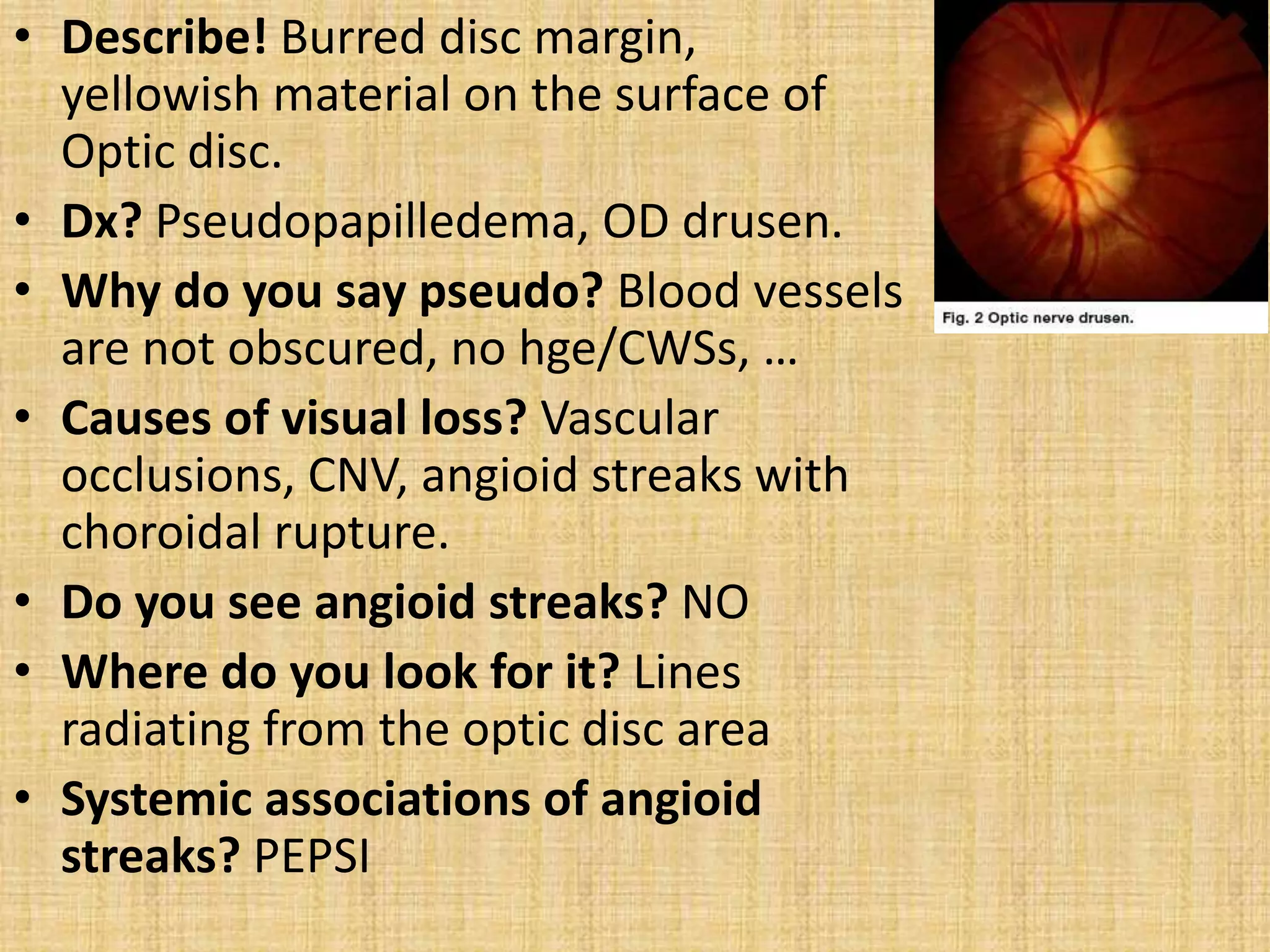 My experience in FRCS Glasgow ophthalmology | PPTX | Eye and Vision ...