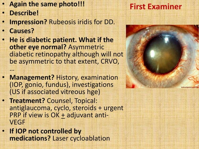 My experience in FRCS Glasgow ophthalmology | PPTX | Eye and Vision ...
