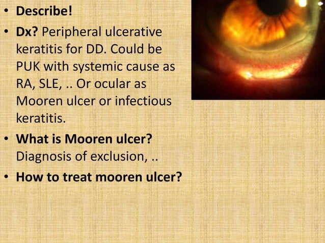 My experience in FRCS Glasgow ophthalmology | PPTX | Eye and Vision ...
