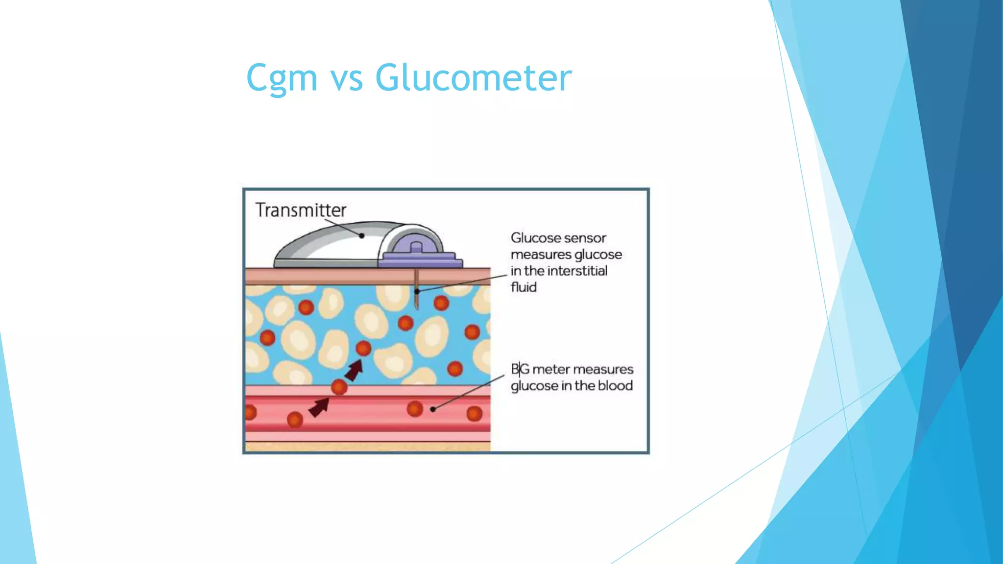 My experience with CGM.pptx