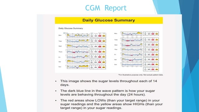 My experience with CGM.pptx