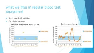 My experience with CGM.pptx