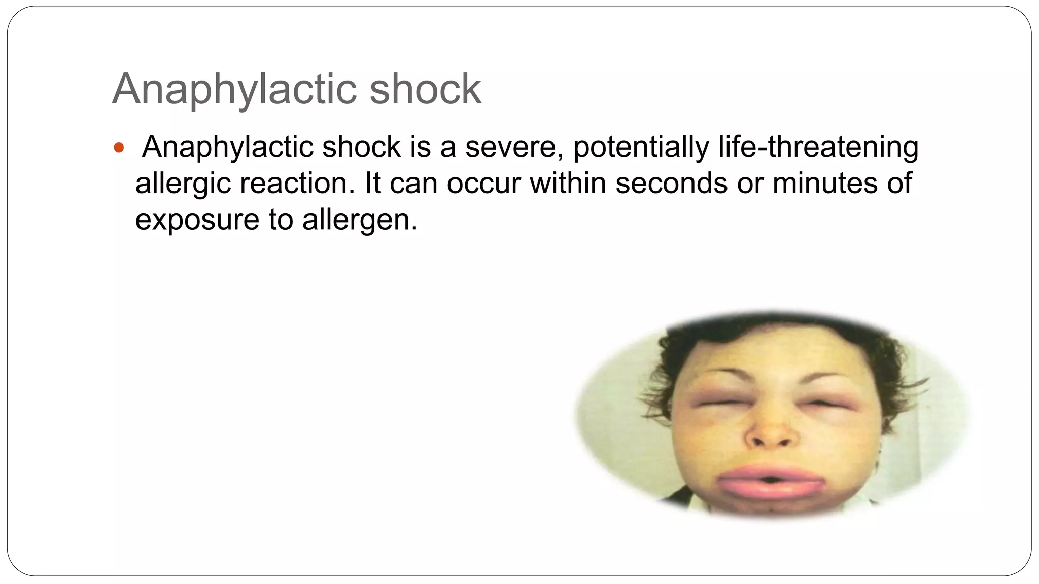 Anaphylactic Shock | PPTX