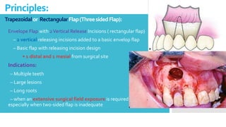 Oral Surgery Flaps Desgning | PDF