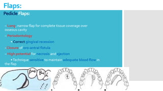 Oral Surgery Flaps Desgning | PDF