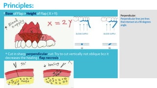 Oral Surgery Flaps Desgning | PDF
