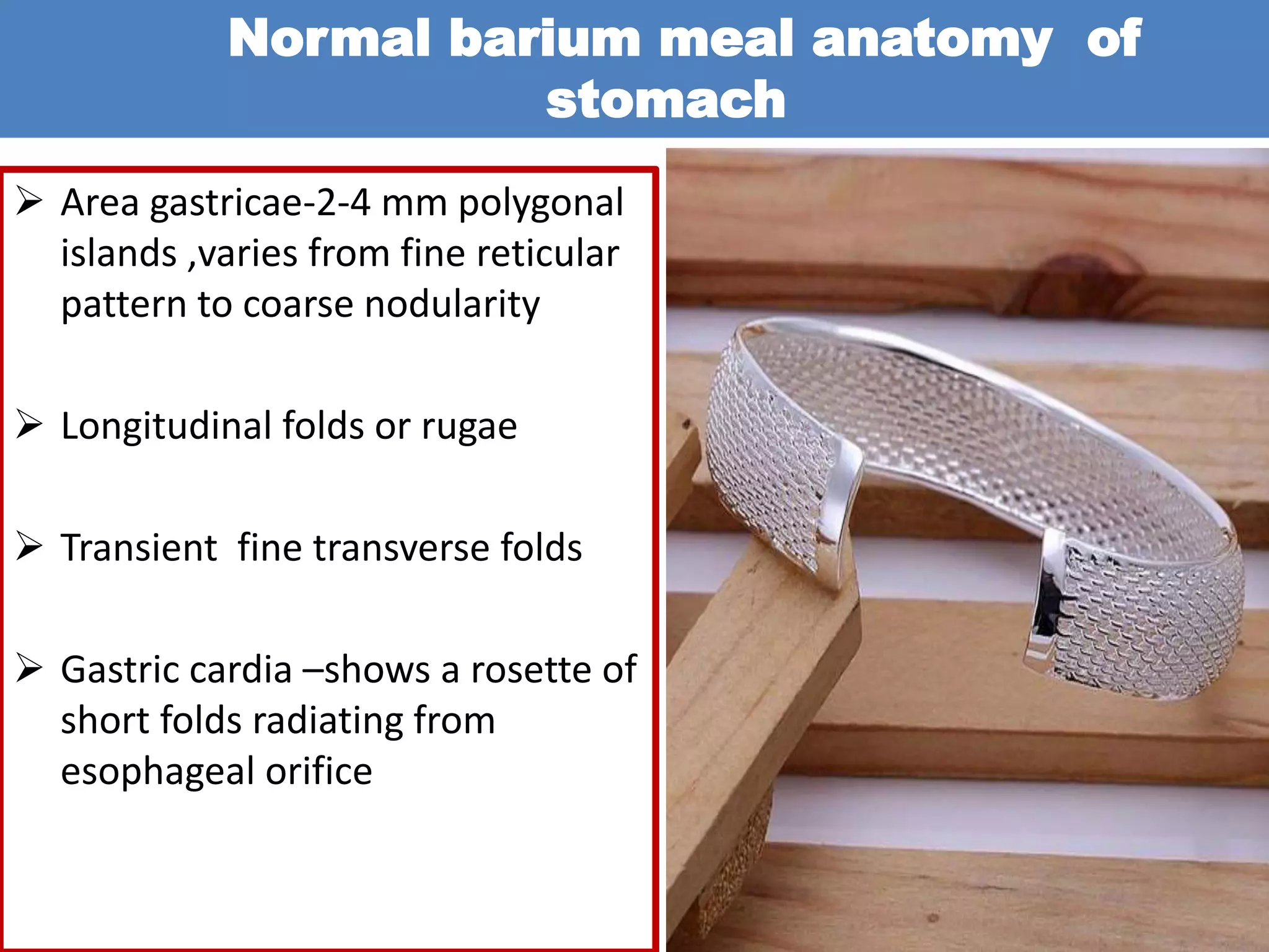 Learn Barium Meal & Follow Through | PPTX