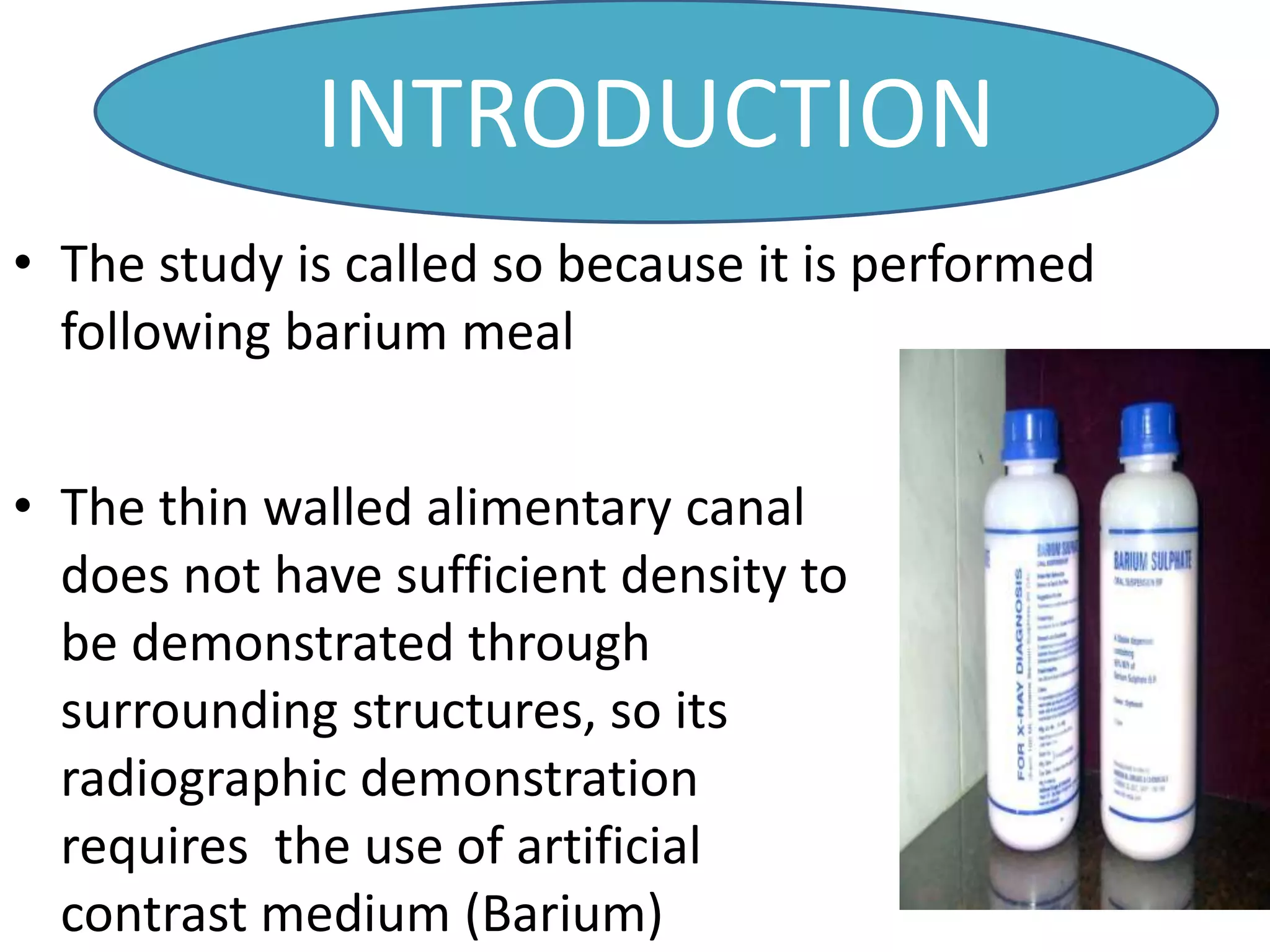 Learn Barium Meal & Follow Through | PPTX