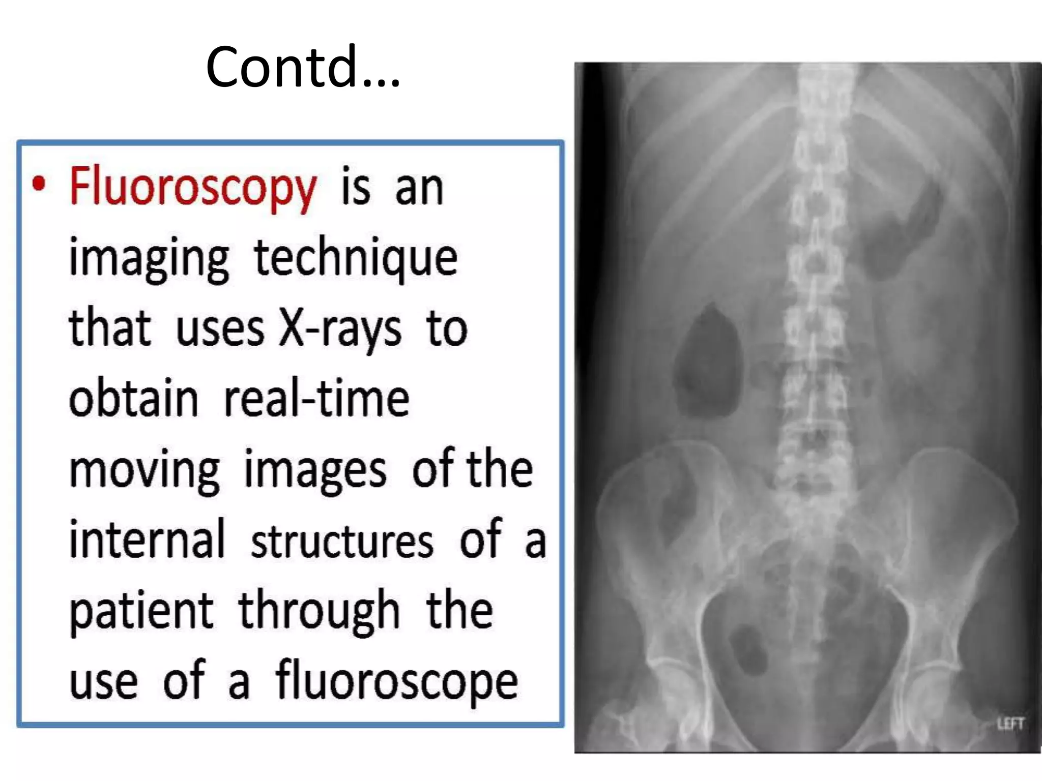 Learn Barium Meal & Follow Through | PPTX