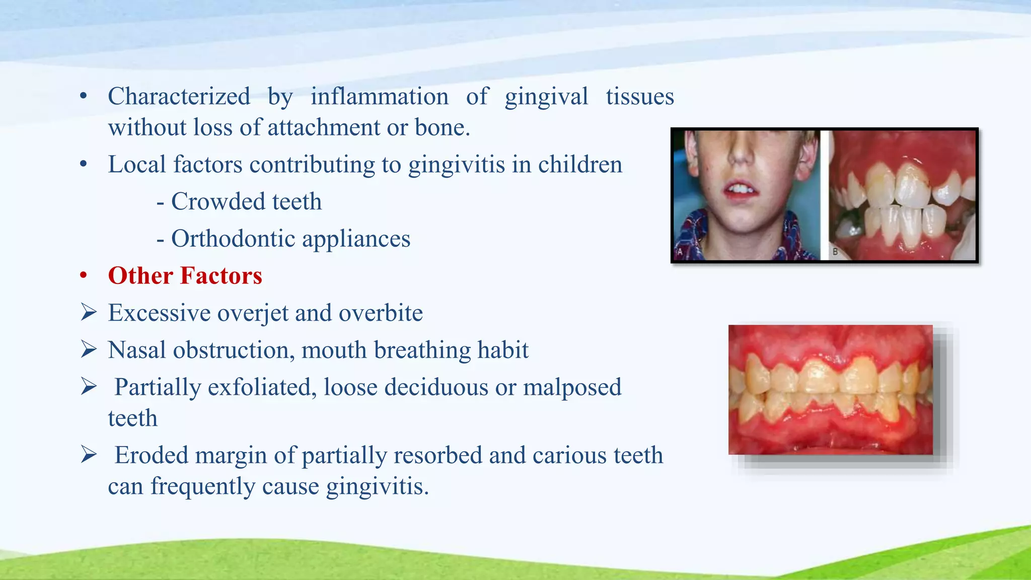 Gingival and periodontal diseases in children | PPTX