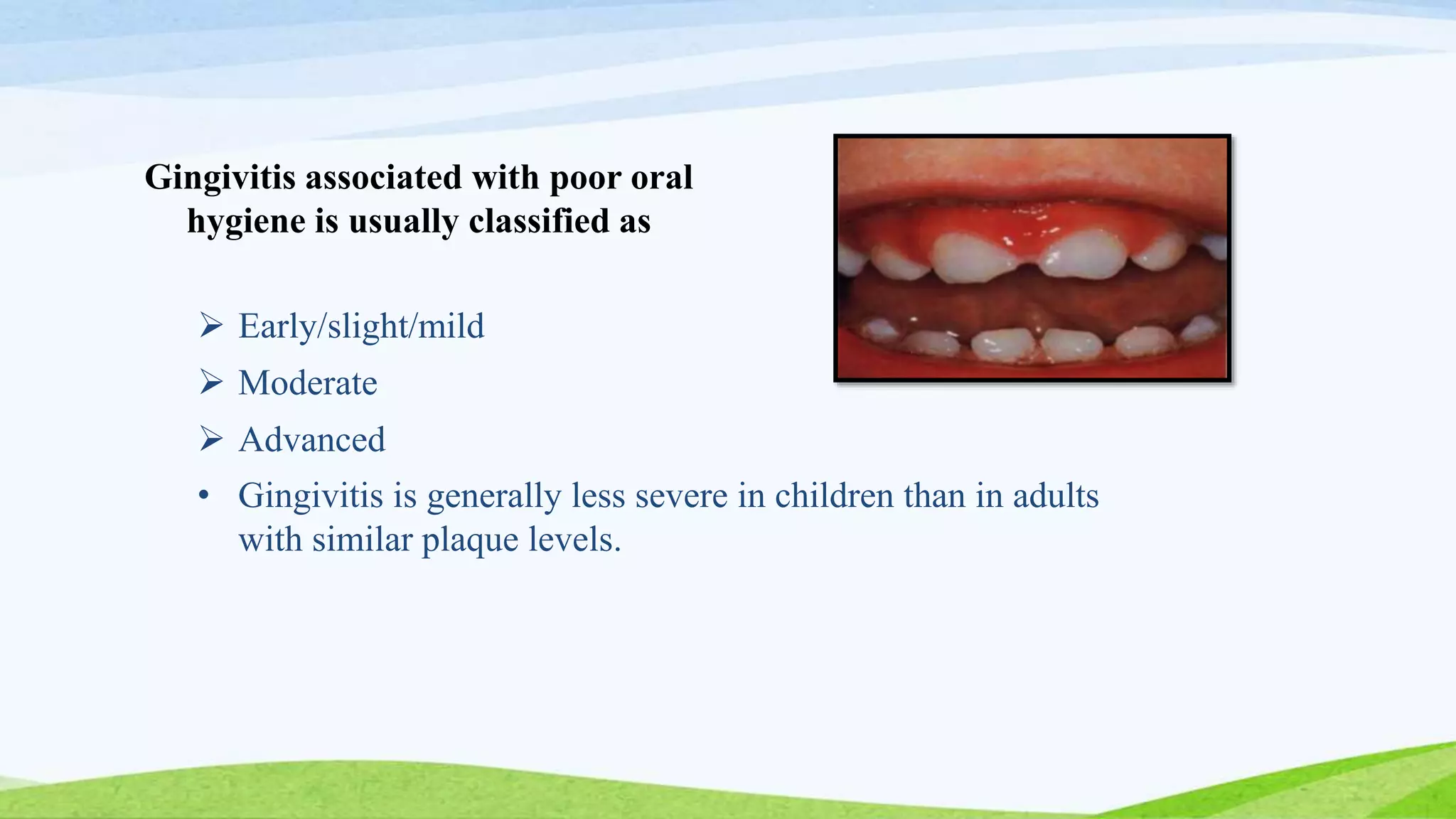 Gingival and periodontal diseases in children | PPTX