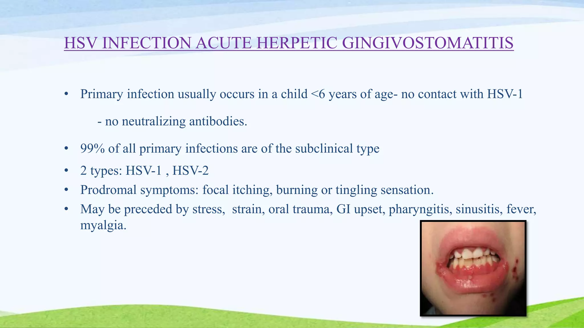 Gingival and periodontal diseases in children | PPTX
