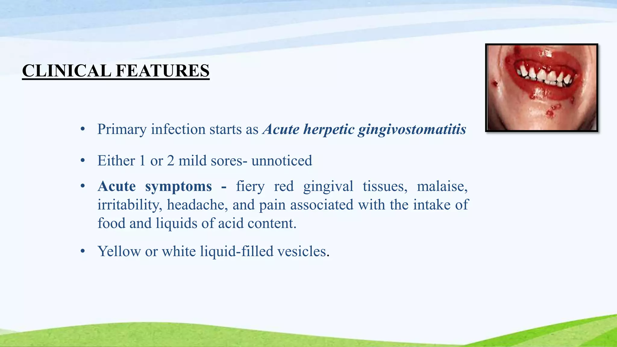 Gingival and periodontal diseases in children | PPTX