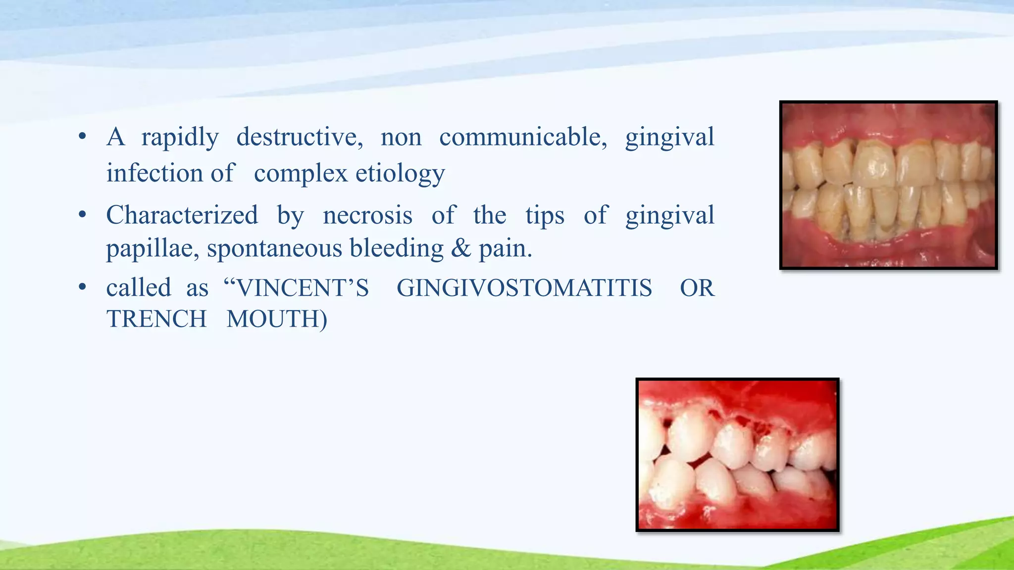 Gingival and periodontal diseases in children | PPTX