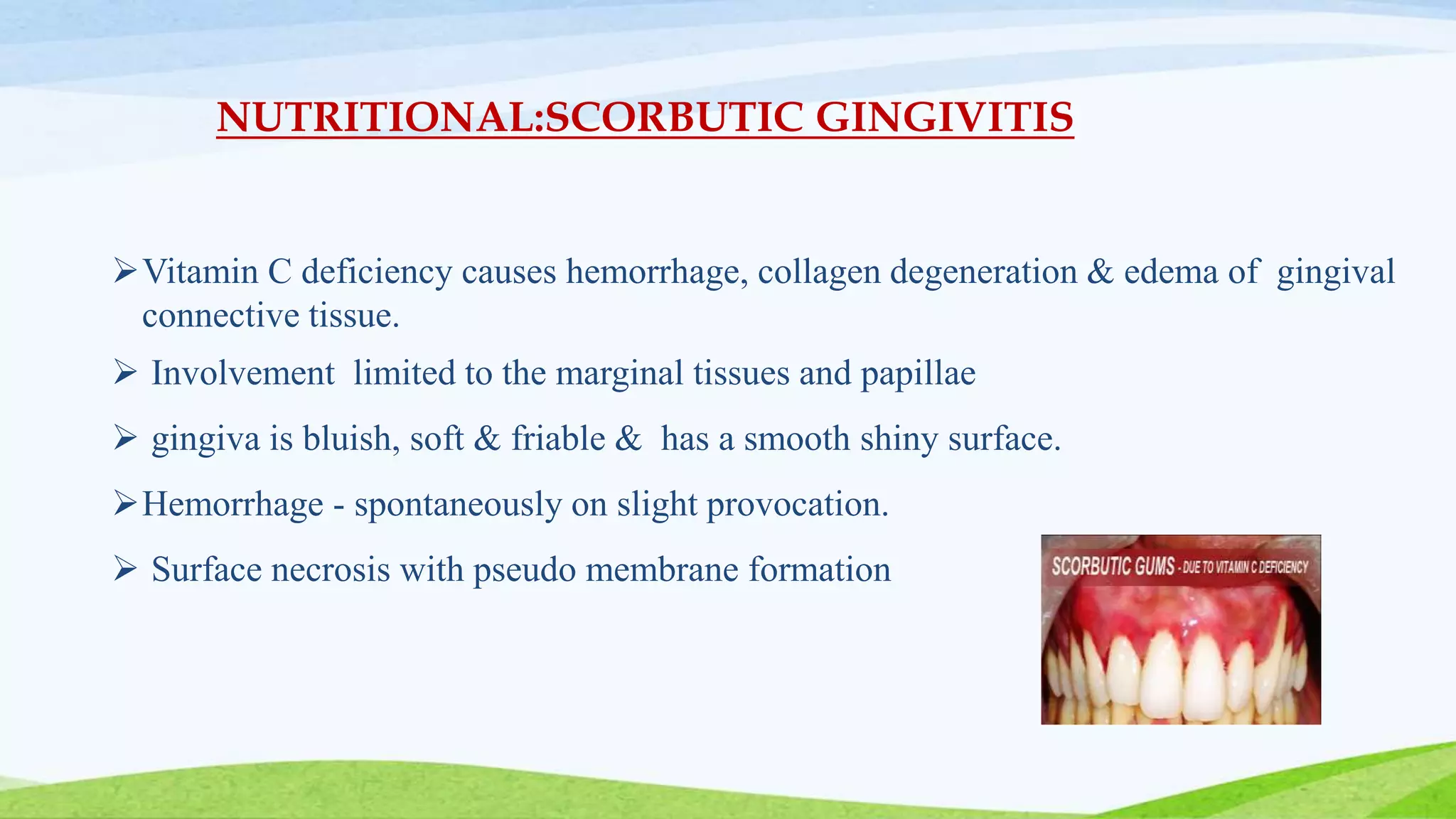Gingival and periodontal diseases in children | PPTX