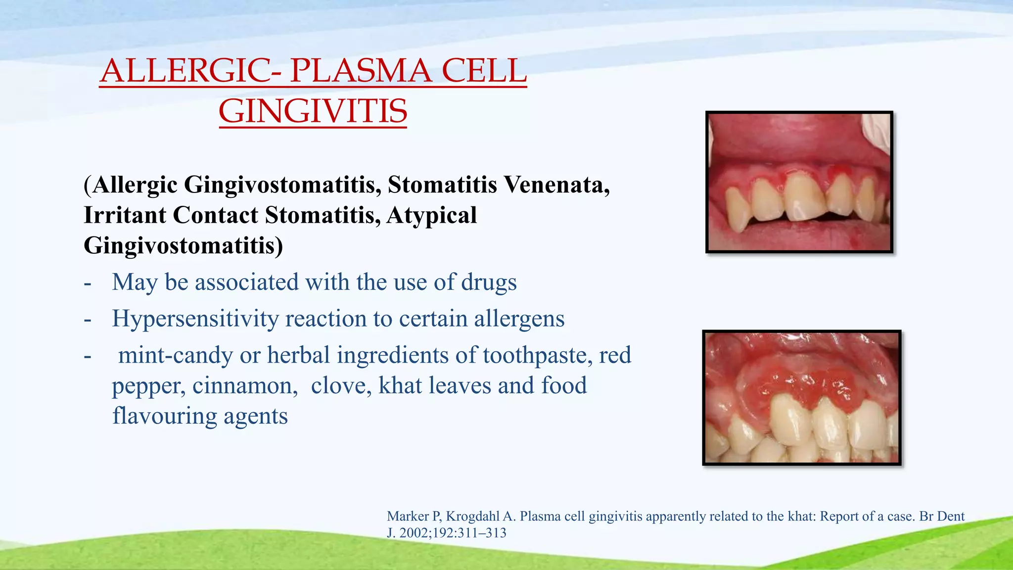 Gingival and periodontal diseases in children | PPTX