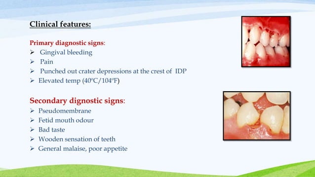 Gingival and periodontal diseases in children | PPTX