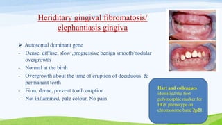 Gingival and periodontal diseases in children | PPTX