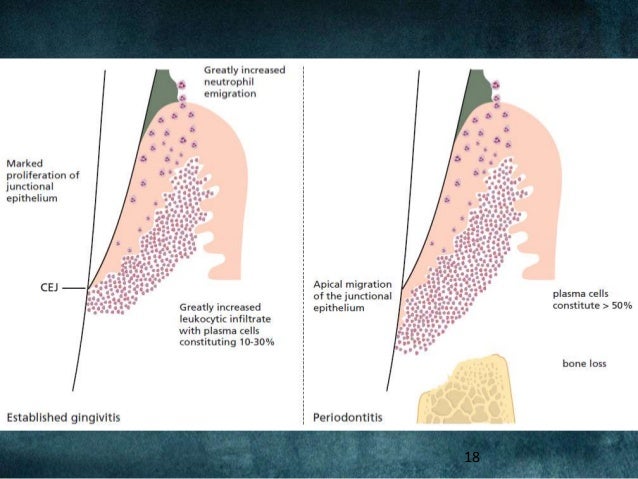 CLINICAL FEATURES OF GINGIVITIS AND ITS CORRELATION WITH MICROSCOPIC