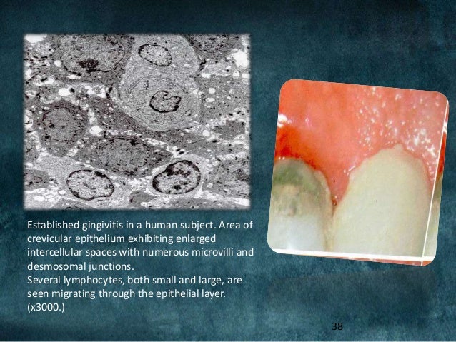 CLINICAL FEATURES OF GINGIVITIS AND ITS CORRELATION WITH MICROSCOPIC