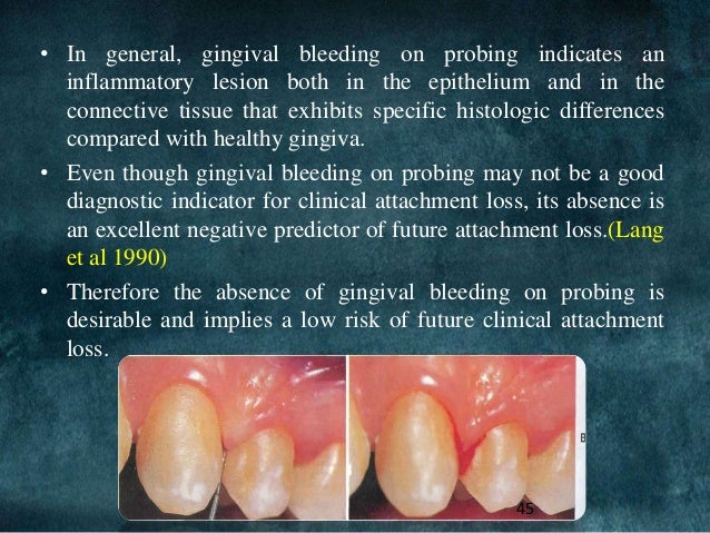 CLINICAL FEATURES OF GINGIVITIS AND ITS CORRELATION WITH MICROSCOPIC