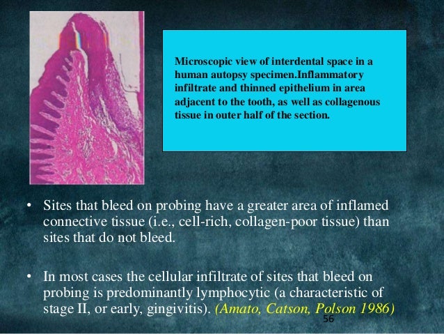 CLINICAL FEATURES OF GINGIVITIS AND ITS CORRELATION WITH MICROSCOPIC
