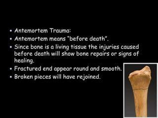 Forensic Anthrpology | PPTX