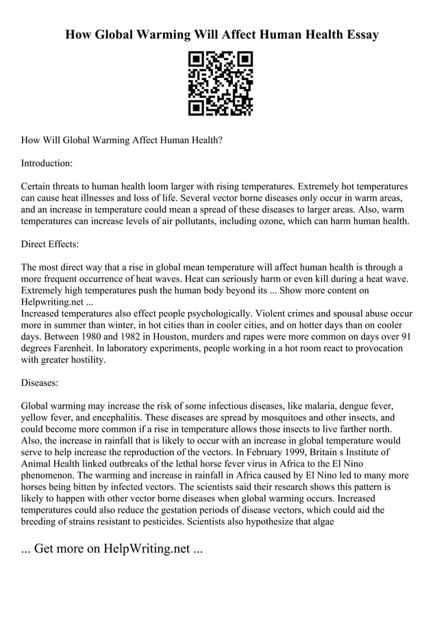 My Hobby Essay In English 100 Words | PDF