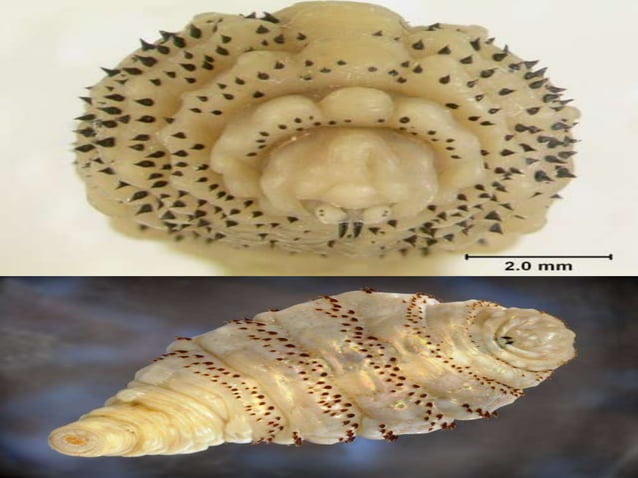 Myiasis by aseem | PPTX | Digestive Disorders | Diseases and Conditions