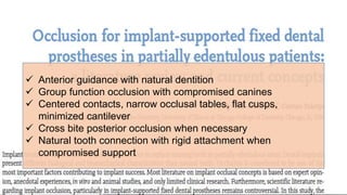 Implant occlusion | PPTX