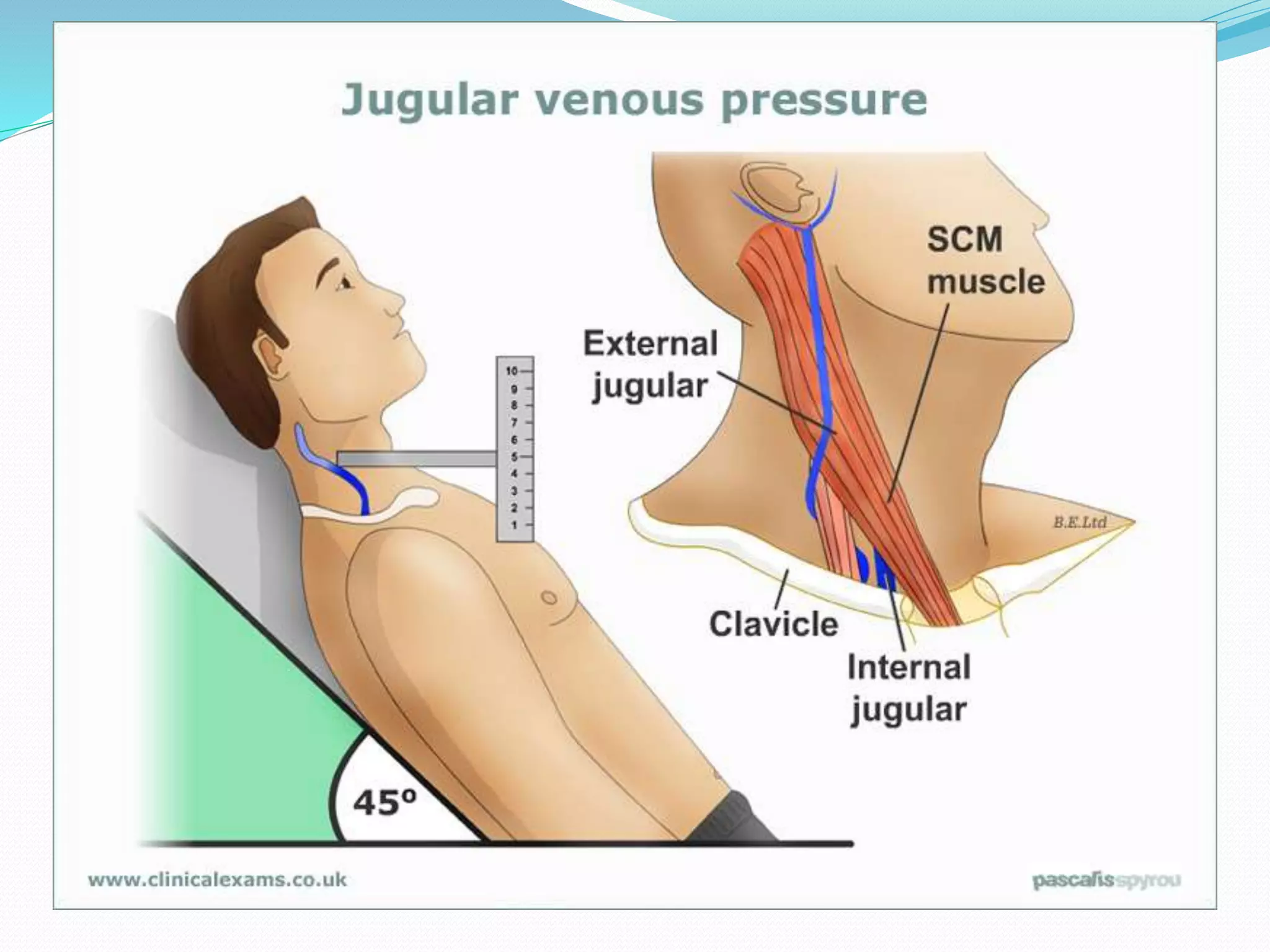 Jugular venous pressure | PPTX