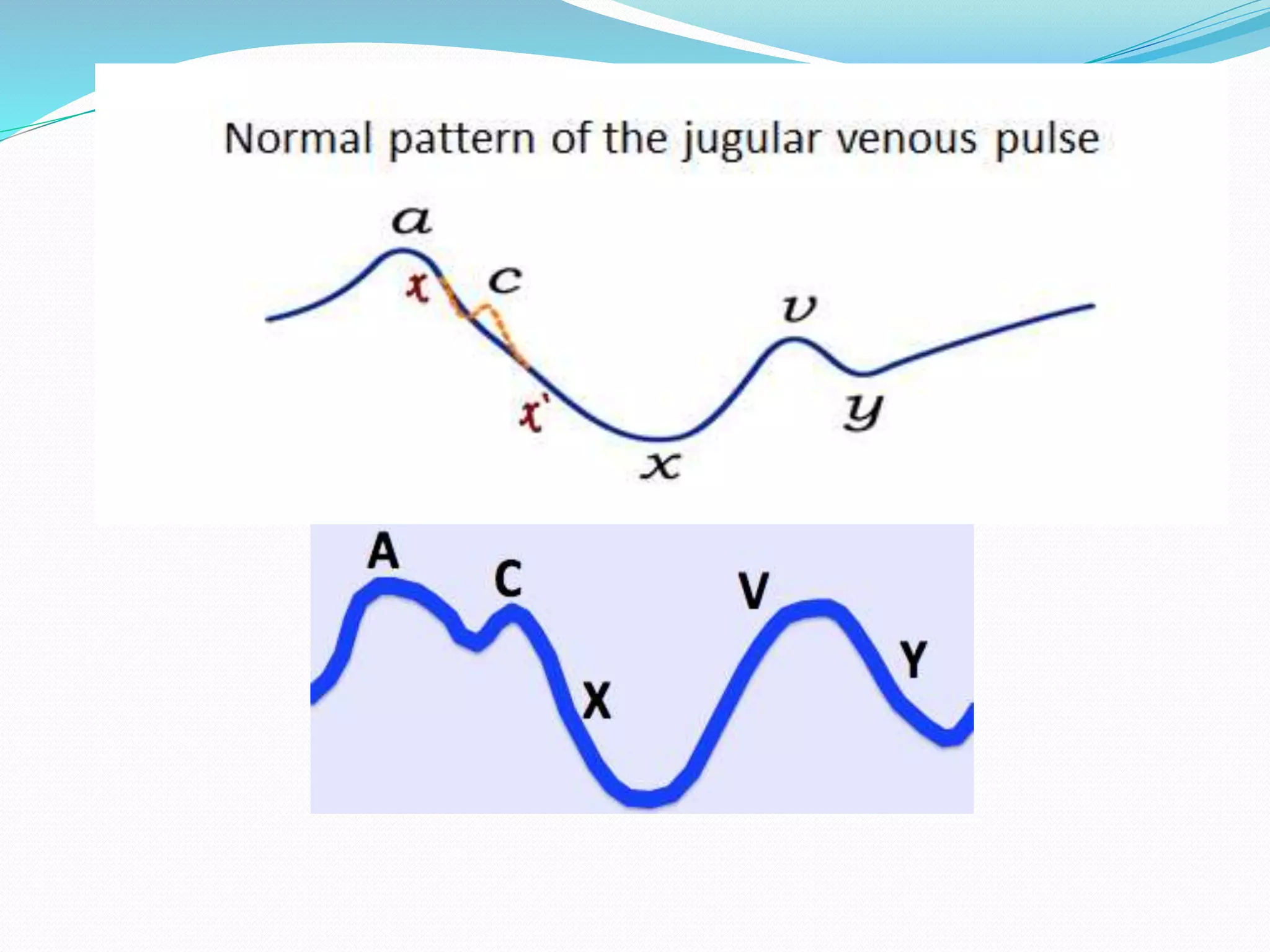 Jugular venous pressure | PPTX