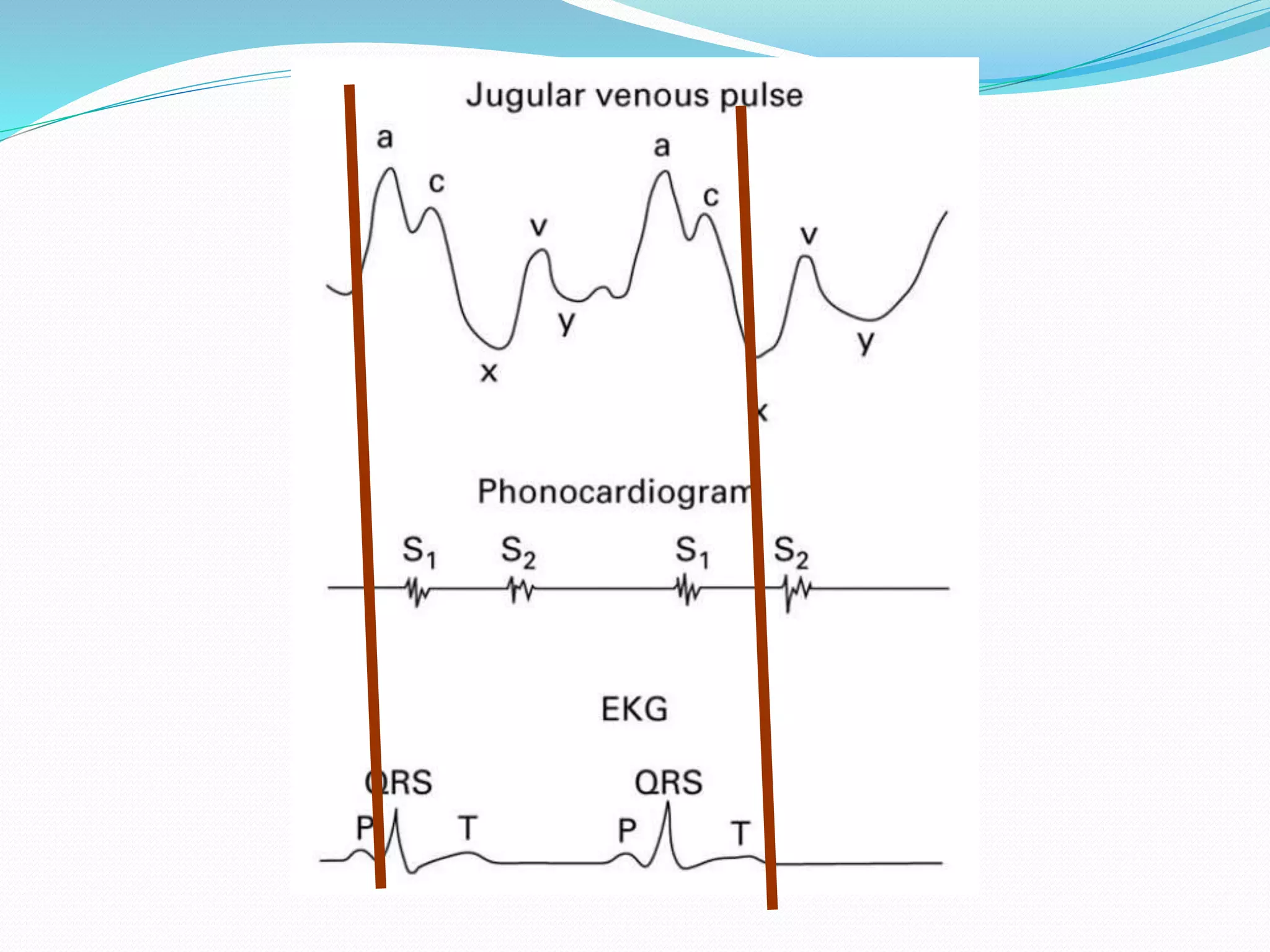 Jugular venous pressure | PPTX