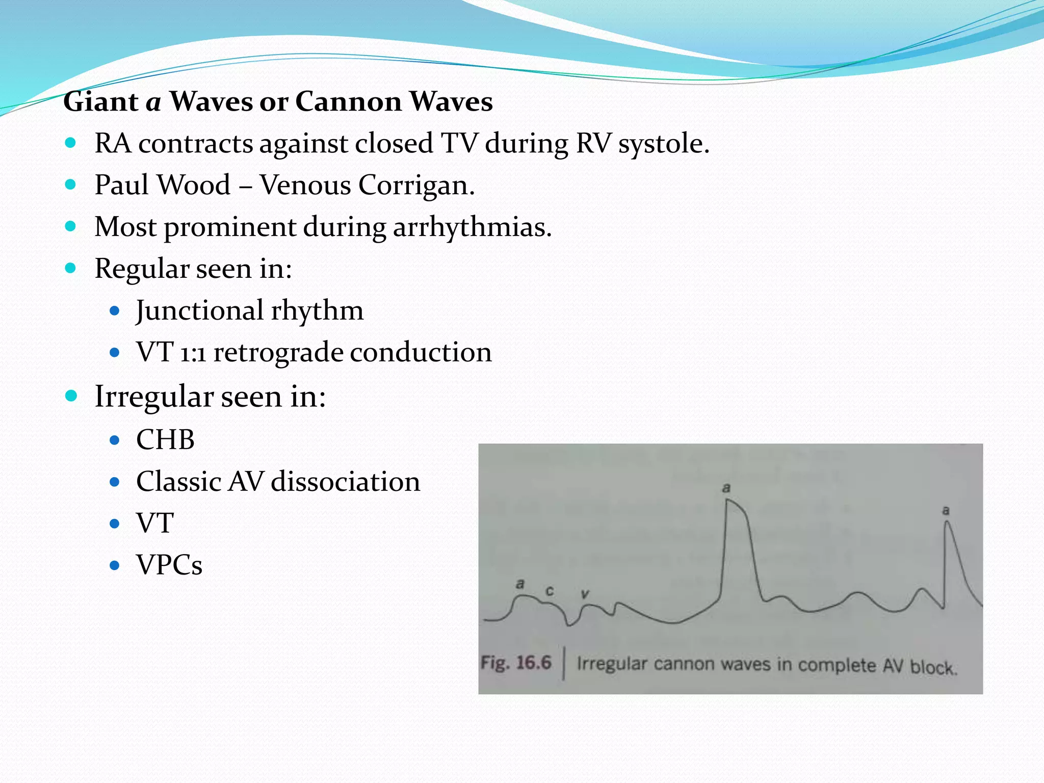 Jugular venous pressure | PPTX