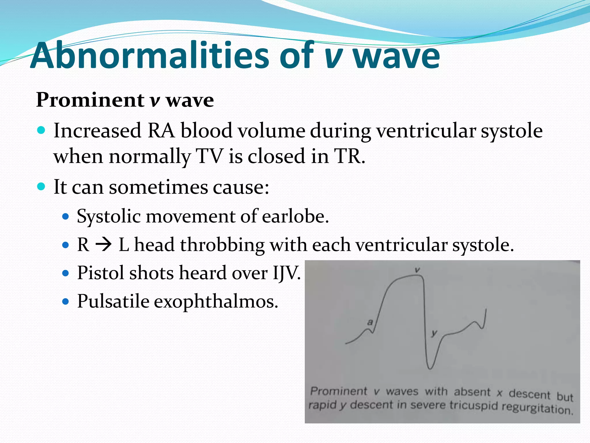 Jugular venous pressure | PPTX