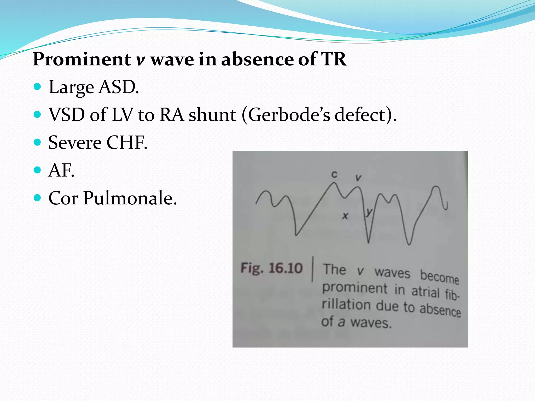 Jugular venous pressure | PPTX