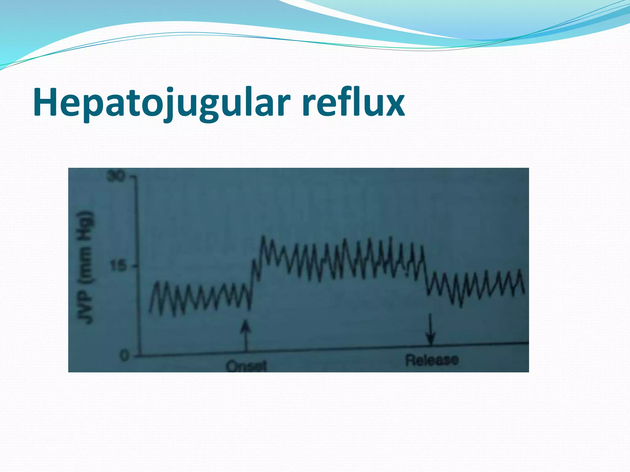 Jugular venous pressure | PPTX