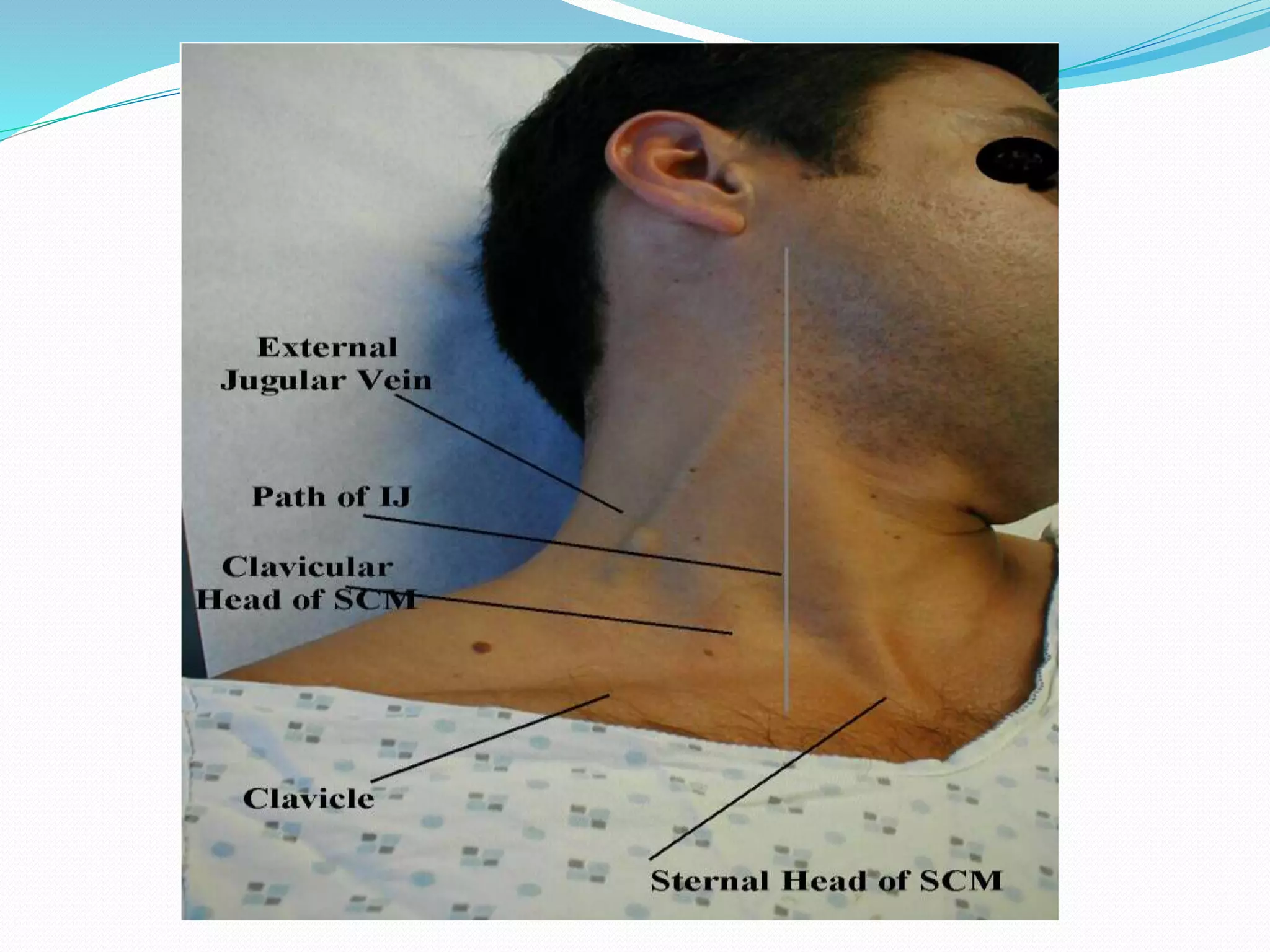 Jugular venous pressure | PPTX