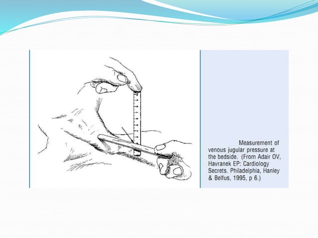 Jugular venous pressure | PPTX | Heart and Cardiovascular Diseases ...